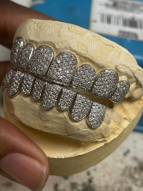 Diamond Grillz | Grillz Done Right